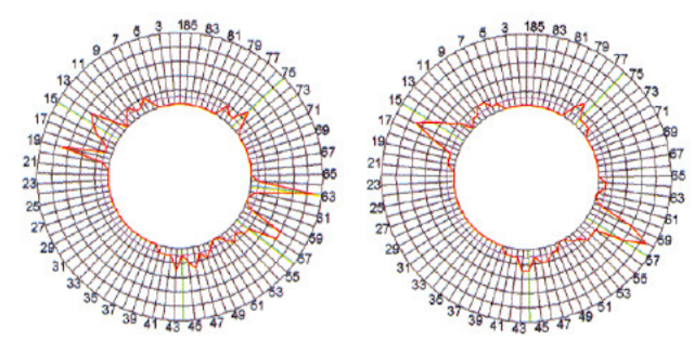 Test de Farnsworth - Munsell