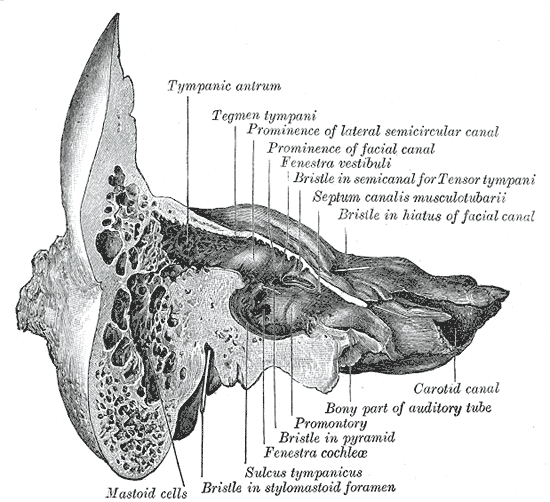 EarNoseThroat-Head&NeckMedicine: PEMBEDAHAN MASTOID