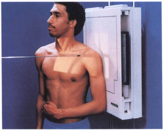 POSTERIOR OBLIQUE POSITION - GLENOID CAVITY: SHOULDER (NONTRAUMA ...