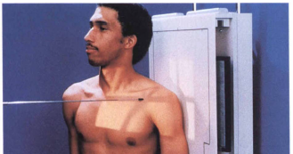 POSTERIOR OBLIQUE POSITION - GLENOID CAVITY: SHOULDER (NONTRAUMA ...