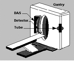 tecnica radiologicas: TOMOGRAFIA AXIAL COMPUTARIZADA