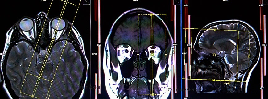MRI Protocols: February 2014