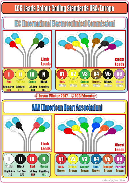 ECG Educator Blog : Introduction to the 12-lead ECG