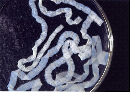 enfermedades preventivas: Teniasis