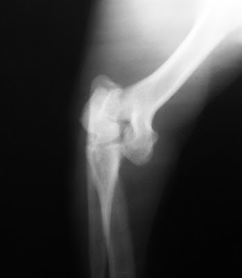 ARTROVET: Fractura del proceso lateral del cóndilo humeral