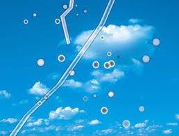 What Are Eye Floaters (Mouches Volantes)?