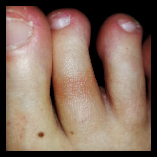 Ms. Wright Explains It All: Toe