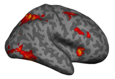 What does fMRI measure? | Brain Metrics | Learn Science at Scitable