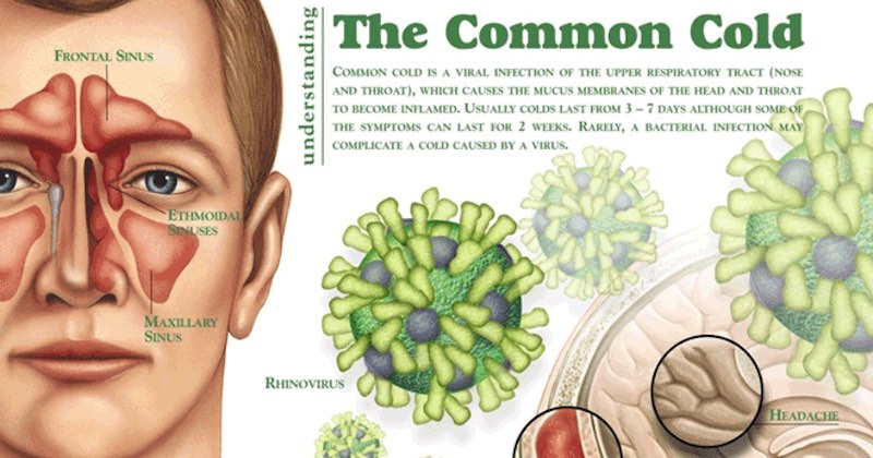 Understanding Common Cold -- Treatments - Money Bag