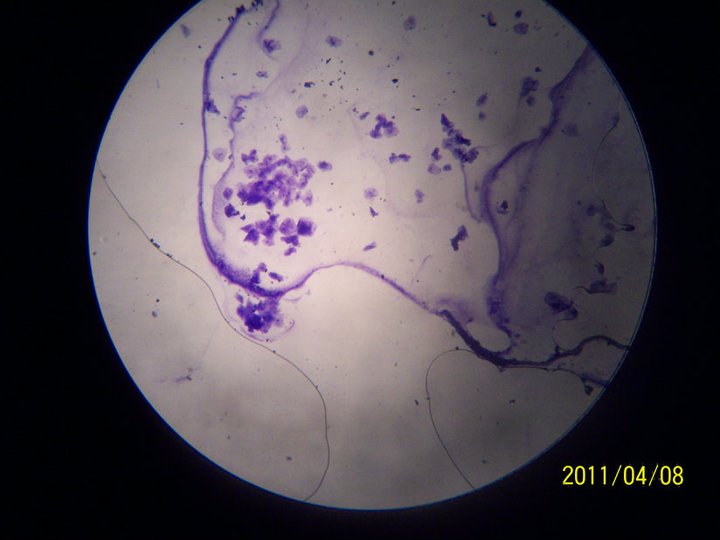 Biología Humana (Claudia y Shaila): Observación del tejido epitelial ...