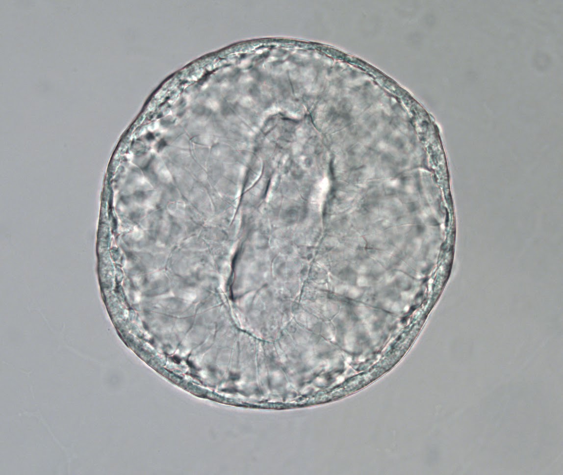 Invertebrate Embryology: Development of the ctenophore Beroe