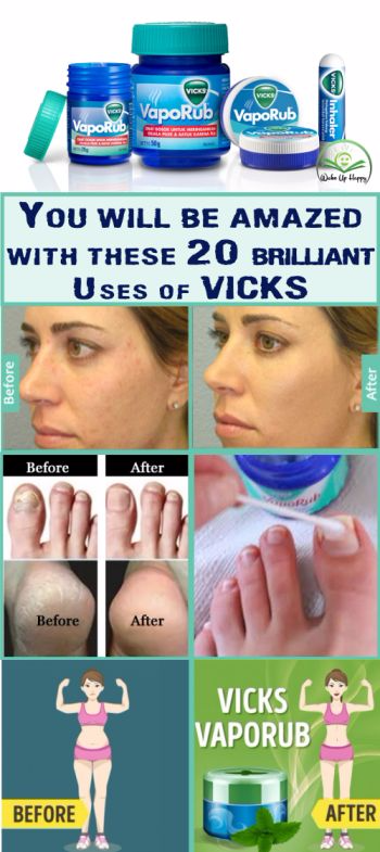 20 Surprising Uses Of Vicks Vaporub You Didnt Know Yet Health Blog