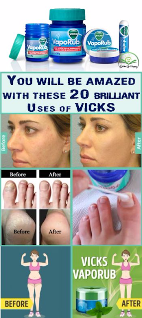 20 Surprising Uses Of Vicks VapoRub You Didn’t Know Yet | HEALTHYTIPS