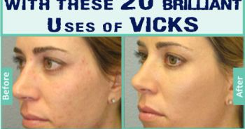 20 Surprising Uses Of Vicks VapoRub You Didn’t Know Yet | HEALTH BLOG