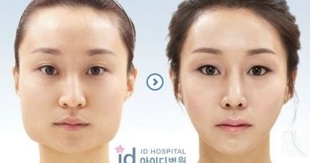 5 Easy Ways to Achieve a V-shaped Face - BEAUTY FOR SHARE