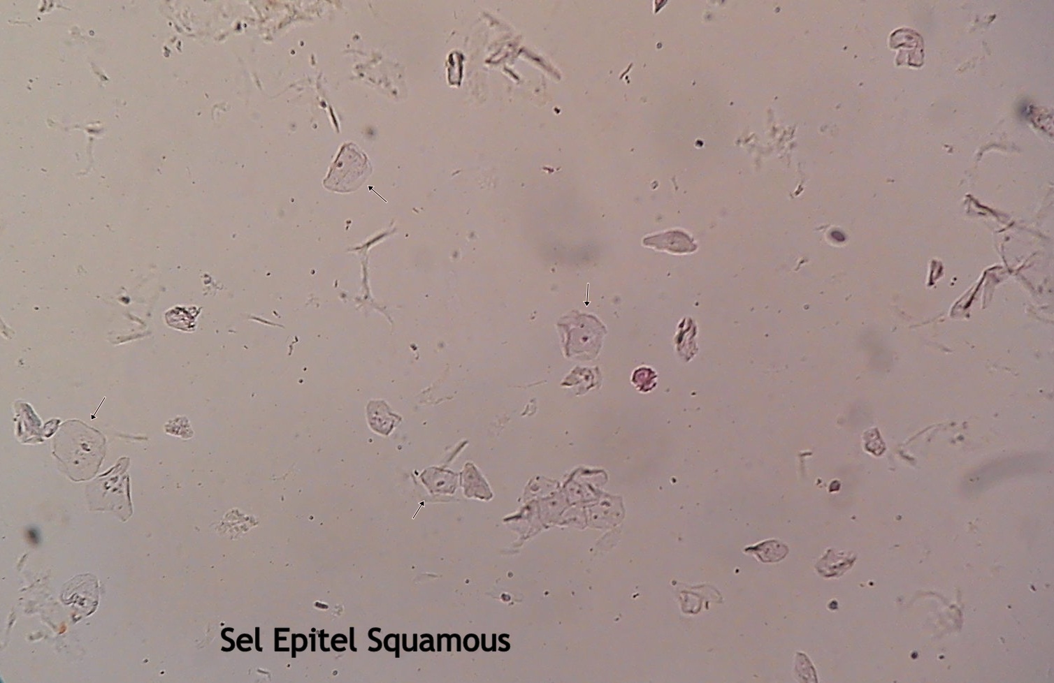 Cara Pemeriksaan Sedimen Urine Metode Terbaru | Noey Lab|Tips Kesehatan ...