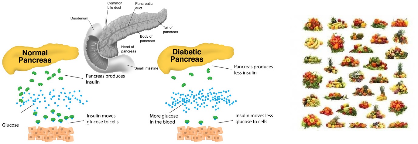 Best Foods For Diabetic Patients - Diabetes Solution