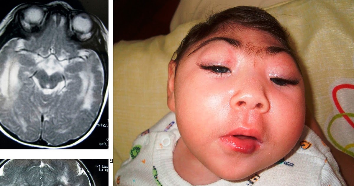 HACIA LA INFINITUD: Tailandia tiene los primeros casos diagnosticados ...