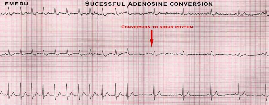 My Working Life: Heart Stopper