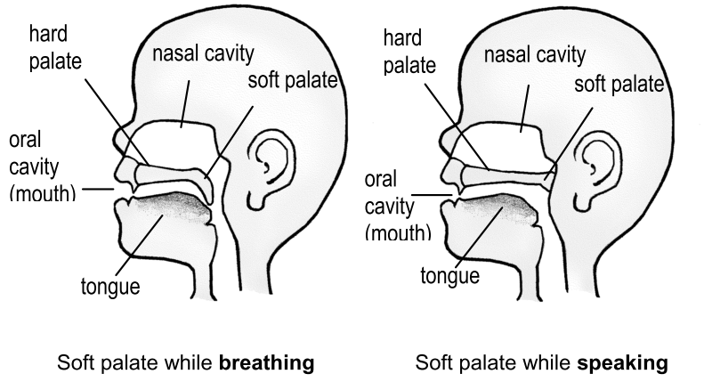 !! Gadis Motor!!: Sumbing Lelangit (Cleft Palate)