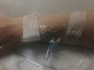 Frozen Woman: Life with Rheumatoid Arthritis: Second Actemra Infusion