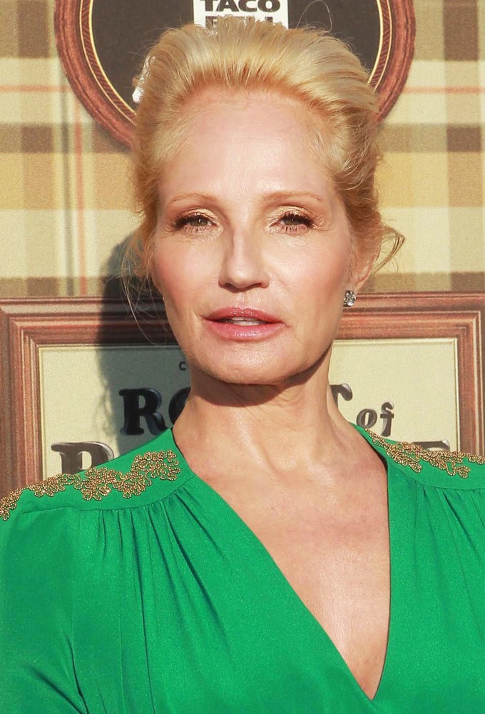 Ellen Barkin Plastic Surgery