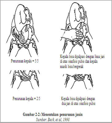 KITA BISA: Letak Sungsang, LIntang dan MUka