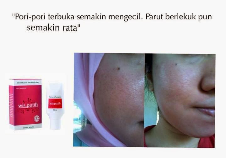 hanimfara.blogspot.com: WIS PUTIH SKINCARE ~ FREE HYDROKINON
