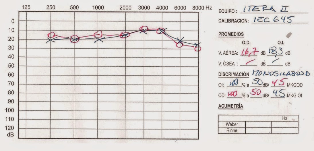 Audiología para Estudiantes: enero 2015