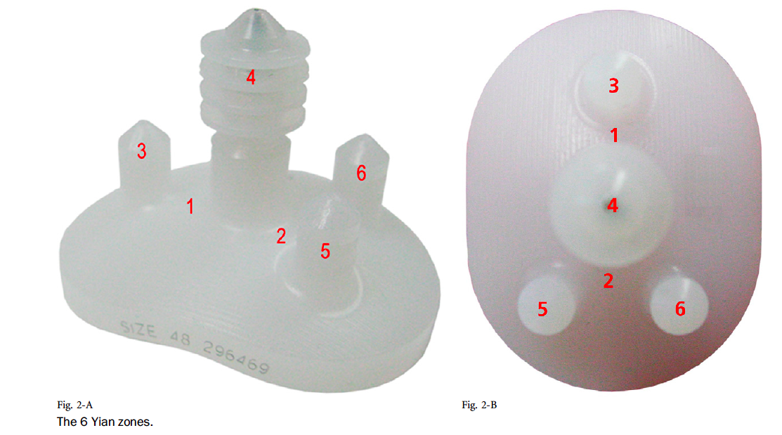 Shoulder Arthritis / Joint Replacement : Advantages of an all ...