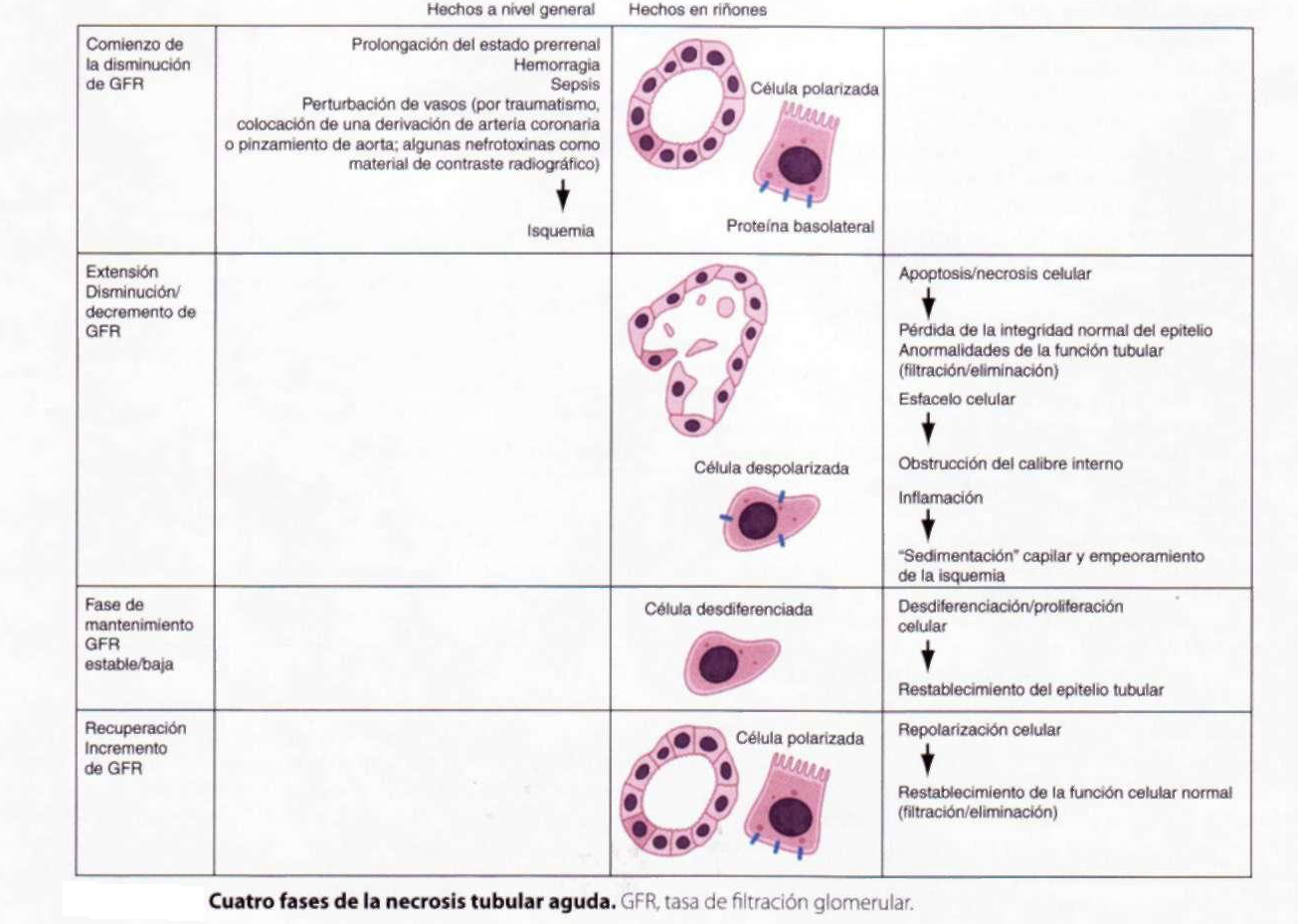 INSUFICIENCIA RENAL AGUDA | Un paseo por la ciencia