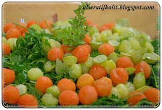 Ülseratif Kolit: Kolit hastaları nasıl beslenmeli?