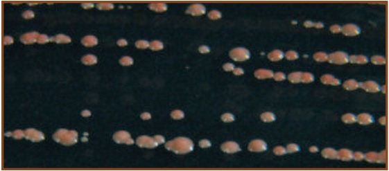 [Microbiology] Atlas of Growth Patterns on Agar | Free Medical Atlas