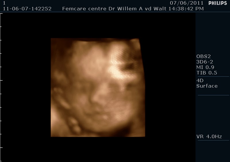 Pregnant Princess: 26 week scan and 4D scan