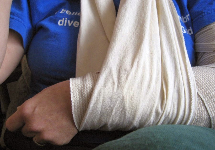 Day Hiking Trails: How to immobilize an arm injured during a hiking trip