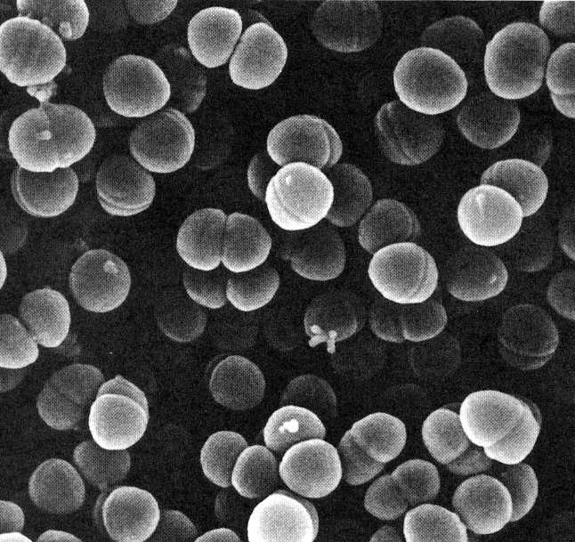 BeautyNB: Pediococcus cerevisiae Bakteri Pembuat Sosis