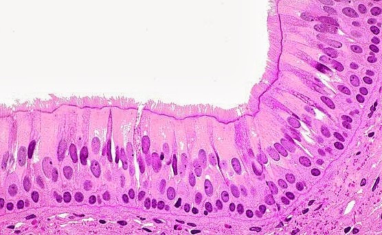 dia cahyani: EPITEL SILINDRIS BERLAPIS