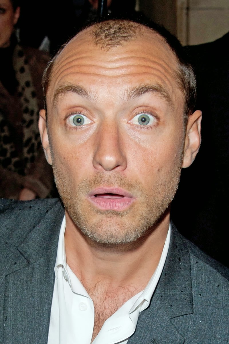 Chatter Busy: Jude Law Hair Transplant