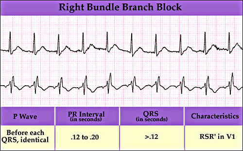 Jefferson CRNA Program Notes: Advanced 1: CARDIOVACULAR ANESTHESIA