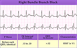 Jefferson CRNA Program Notes: Advanced 1: CARDIOVACULAR ANESTHESIA