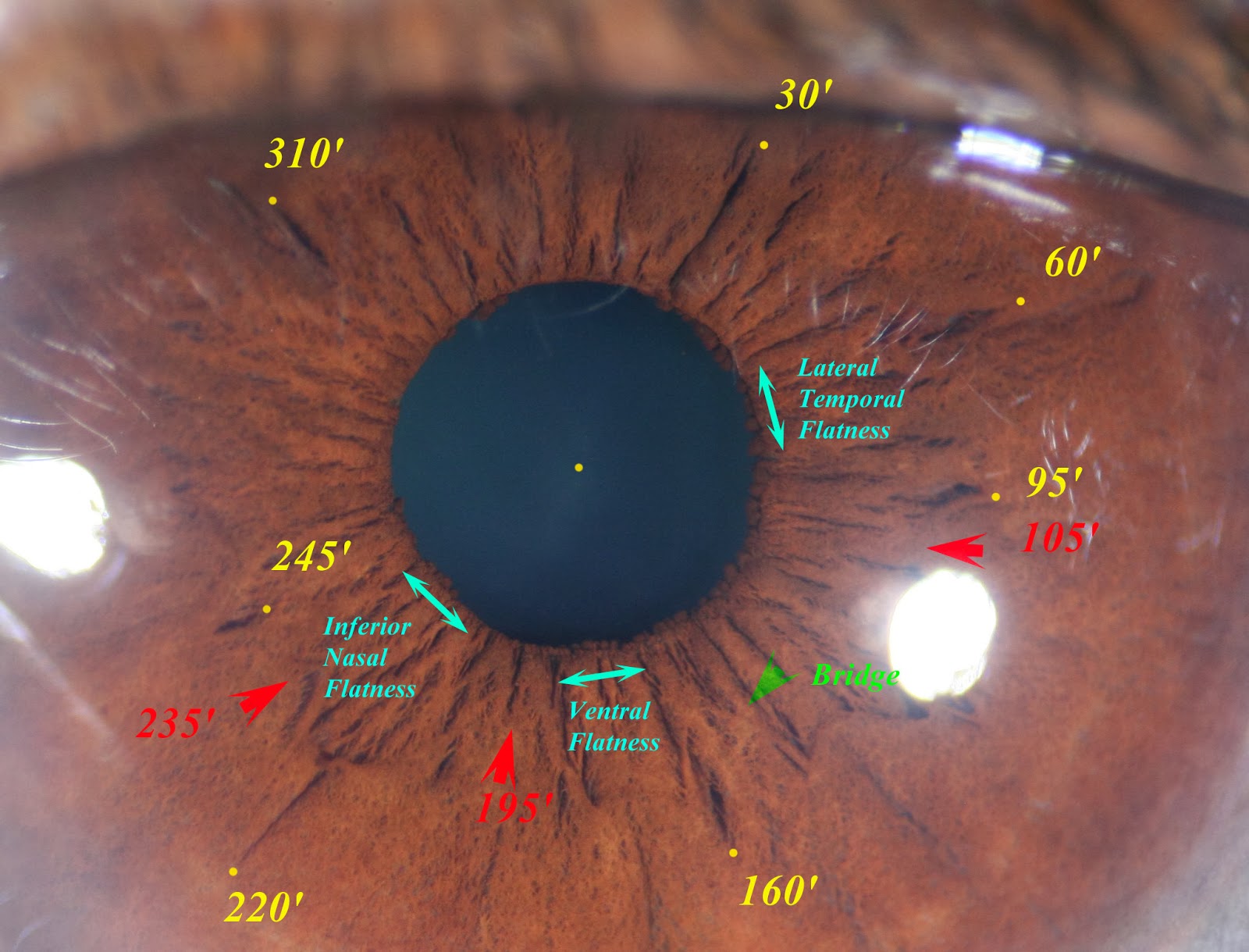 Modern & Multidimensional Iridology: Pupil Flattenings, The ...