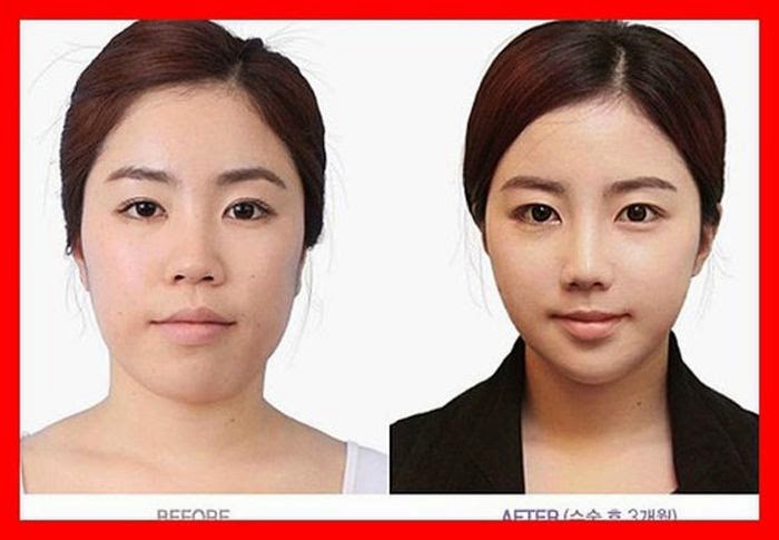 Korean Plastic Surgery Part 2 ~ Damn Cool Pictures