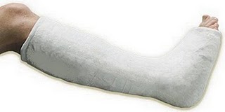 TECNICAS DE ENFERMERIA: RECOMENDACIONES PARA EL PACIENTE VENDADOS CON YESO