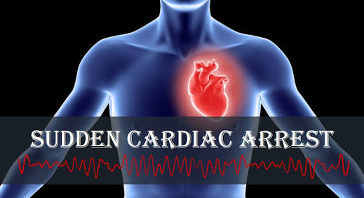 NAIRA HUB: All You Need To Know About Sudden Cardiac Arrest That Causes ...