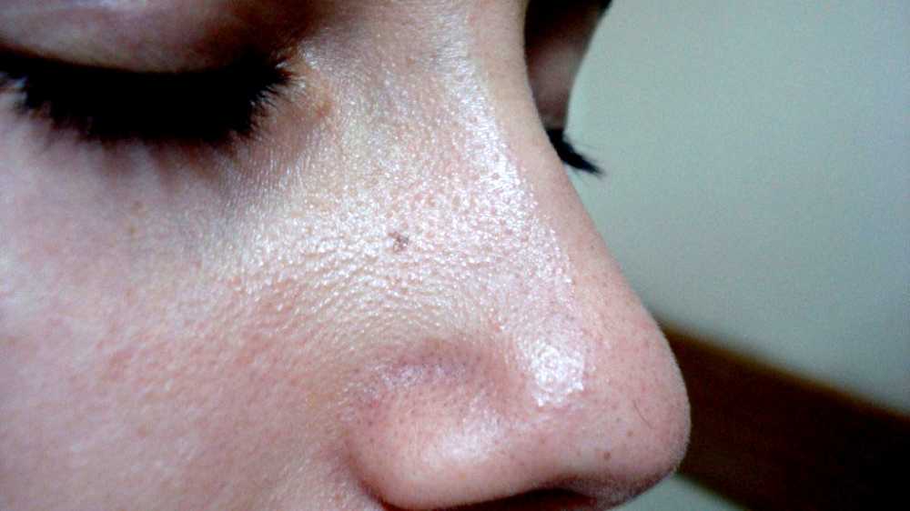 Milium (dermatology)