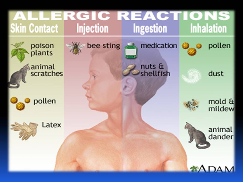 Food allergies versus intolerance: How to know the difference between ...