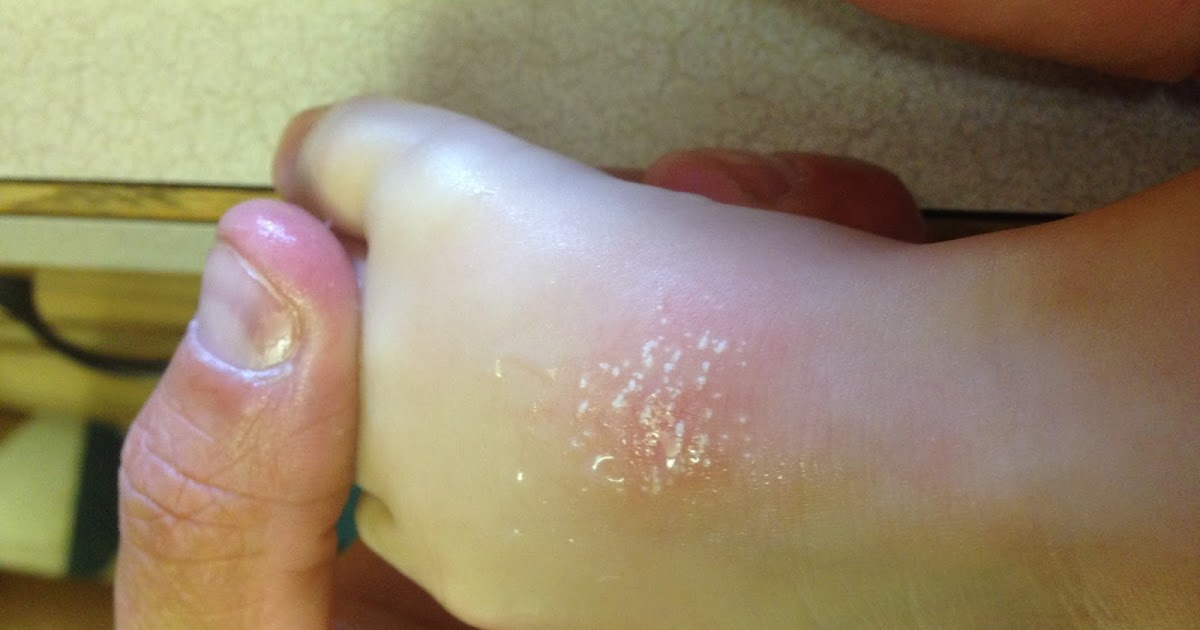 The "Secret" is Gratitude: Who Will Help the Babies.... Horsehair ...