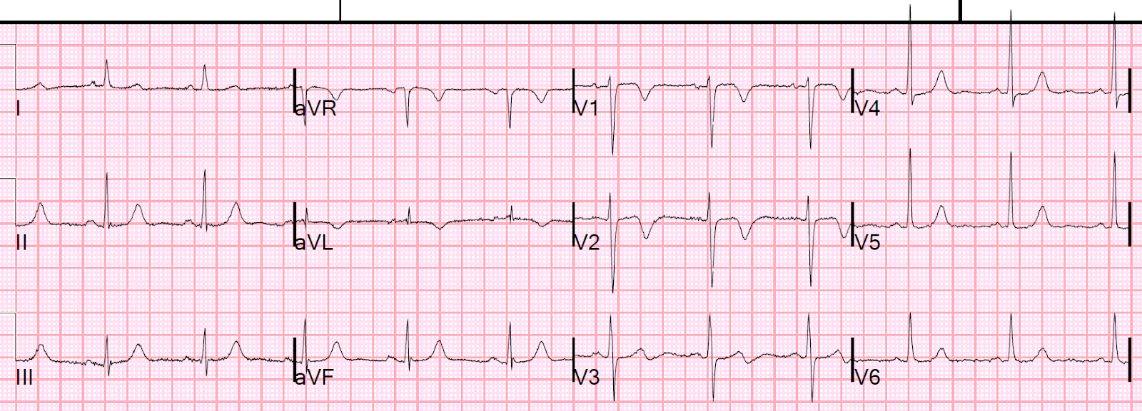 Dr. Smith's ECG Blog