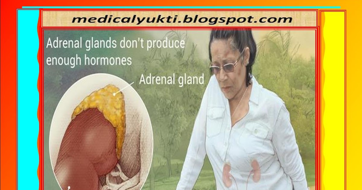 Addison's disease - Medical Yukti