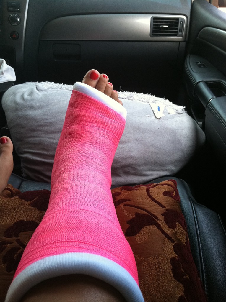 Casts and Toes: June 2011